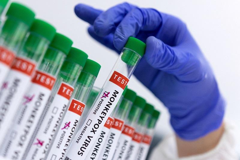 Quezon City logs 2nd, 3rd mpox cases - Philippine Daily Post